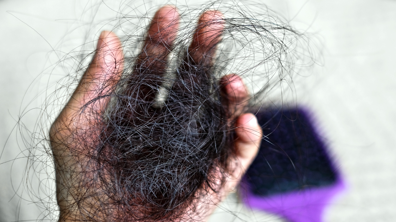 How Can You Stop Hair from Falling Out When It Won’t Seem to Stop? 2025 ...